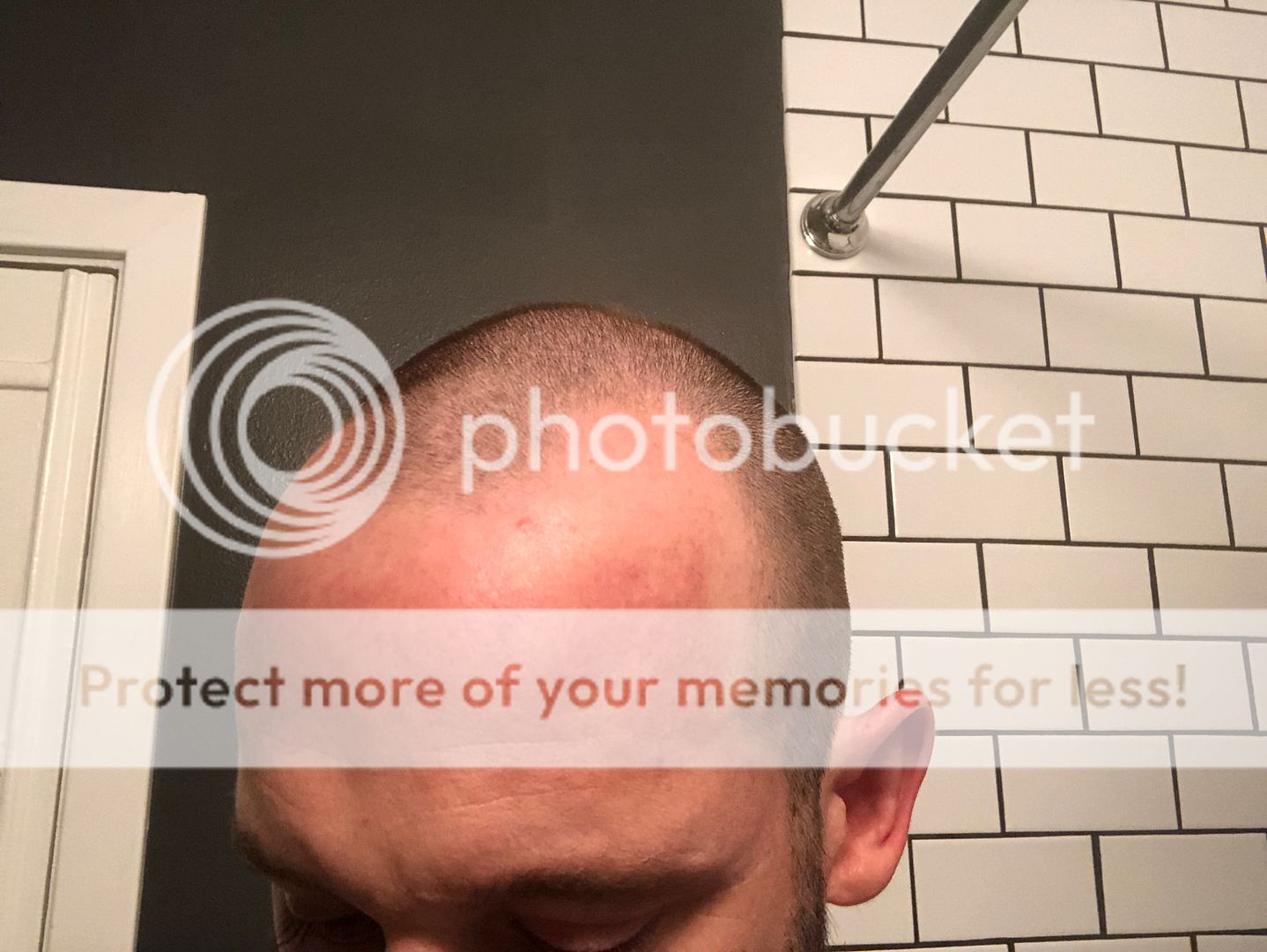 Scalp skin color different from forehead color : r/AskDocs